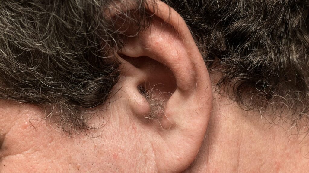Hair in the ears, why they appear and how to remove them safely ...
